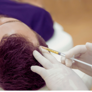 Hair Growth Injections | Effective PRP & GFC Treatments