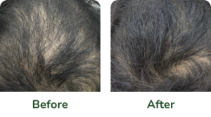 Evenly Skin & Hair Clinic – Trusted Skin & Hair Specialists